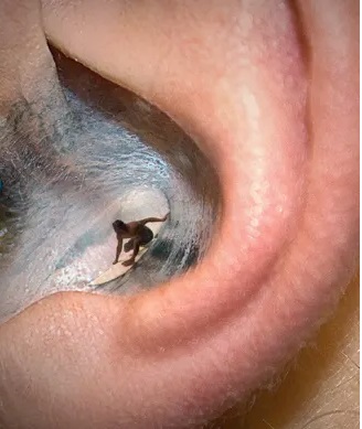 What are the symptoms of 'Swimmer's Ear' and how to treat it - Midland ...